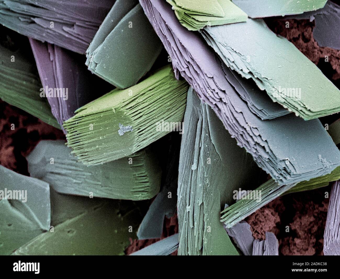 Blood clot crystals. Coloured scanning electron micrograph (SEM) of ...