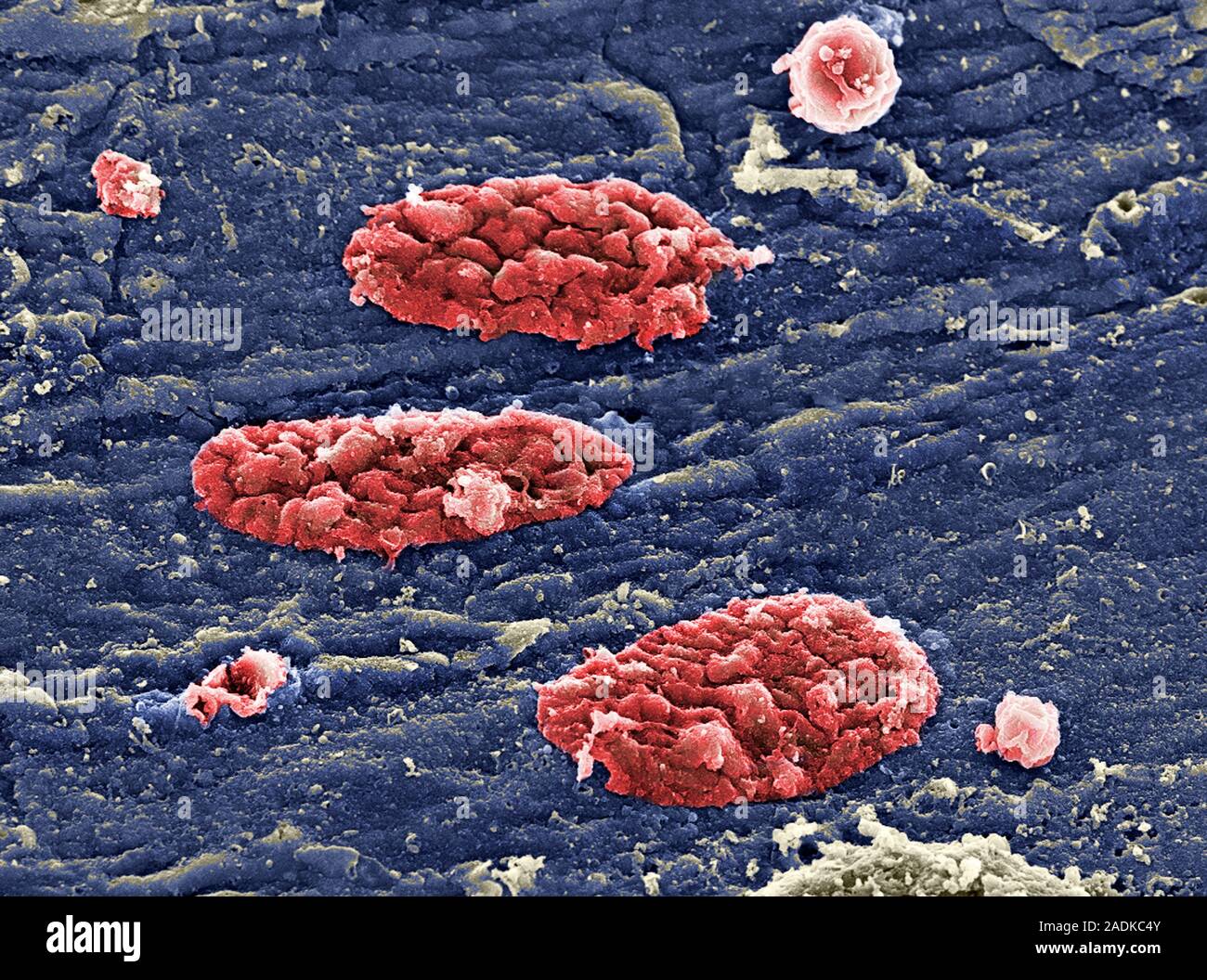 Blood clots. Coloured scanning electron micrograph (SEM) of small blood ...