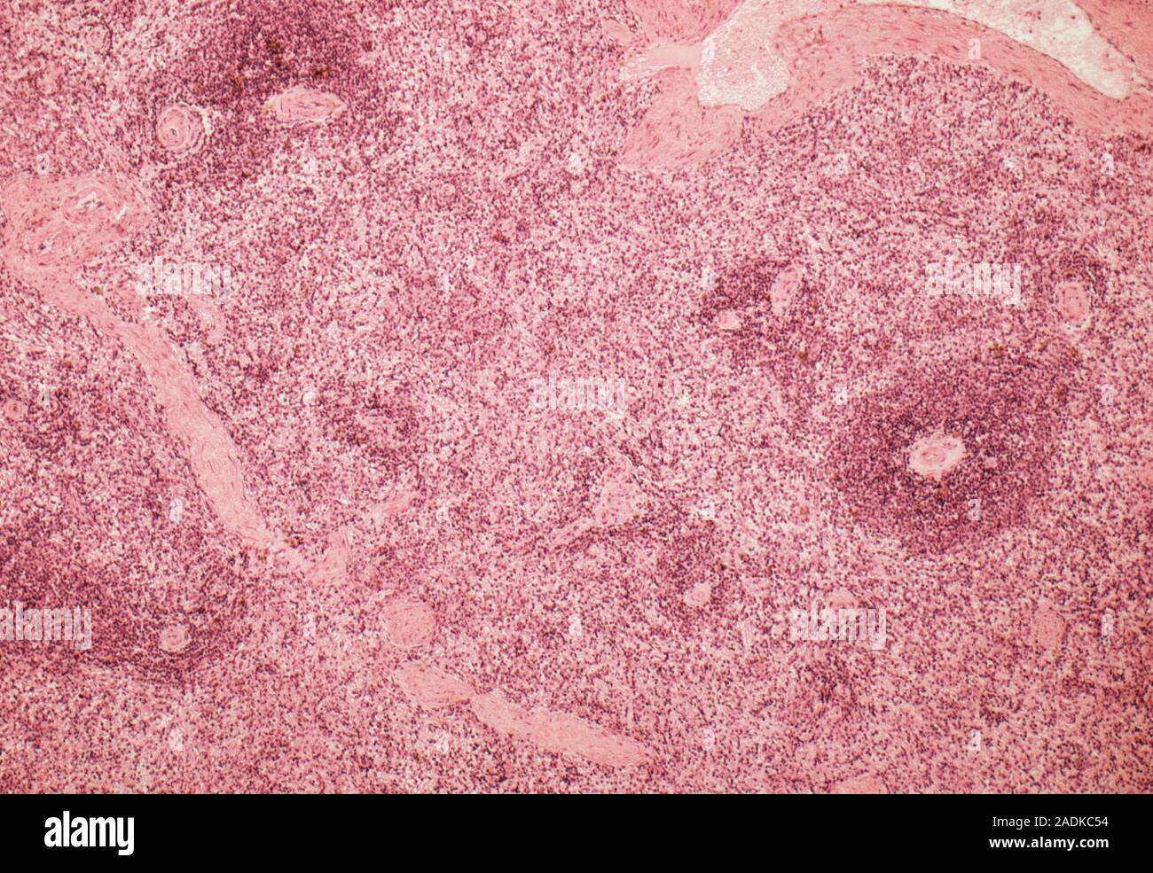 Spleen. Light micrograph of a cross section through the spleen. The ...