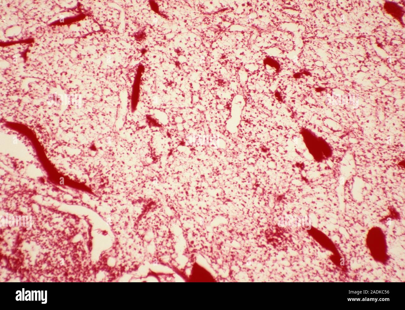 Spleen pulp. Coloured light micrograph (LM) of a section through the ...
