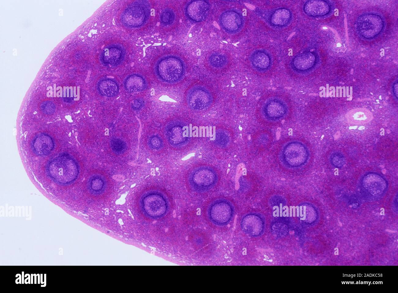 Spleen. Light micrograph of a section through spleen tissue. The spleen ...