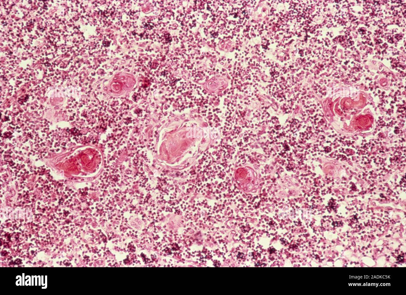 Thymus. Light micrograph of a section through the medulla (inner part ...