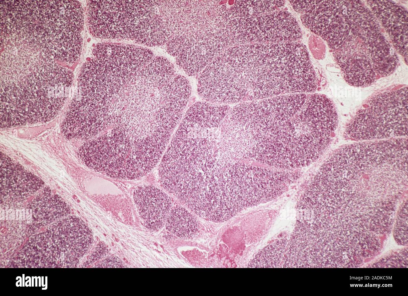 Embryonic thymus. Light micrograph of a section through the immature ...