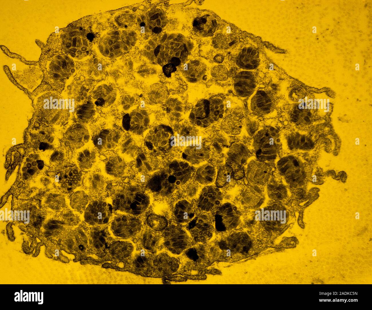False-colour transmission electron micrograph (TEM) of a human mast ...