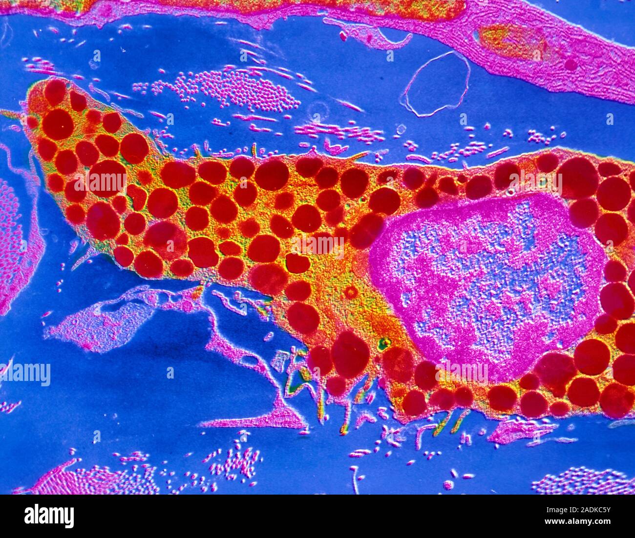 False-colour transmission electron micrograph of a human mast cell or ...