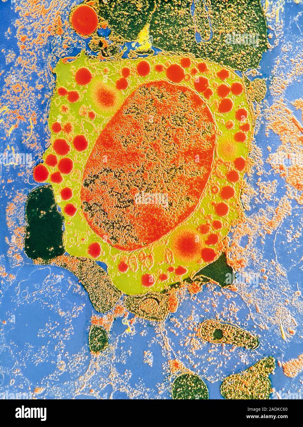 False-colour transmission electron micrograph of a mast cell (central ...