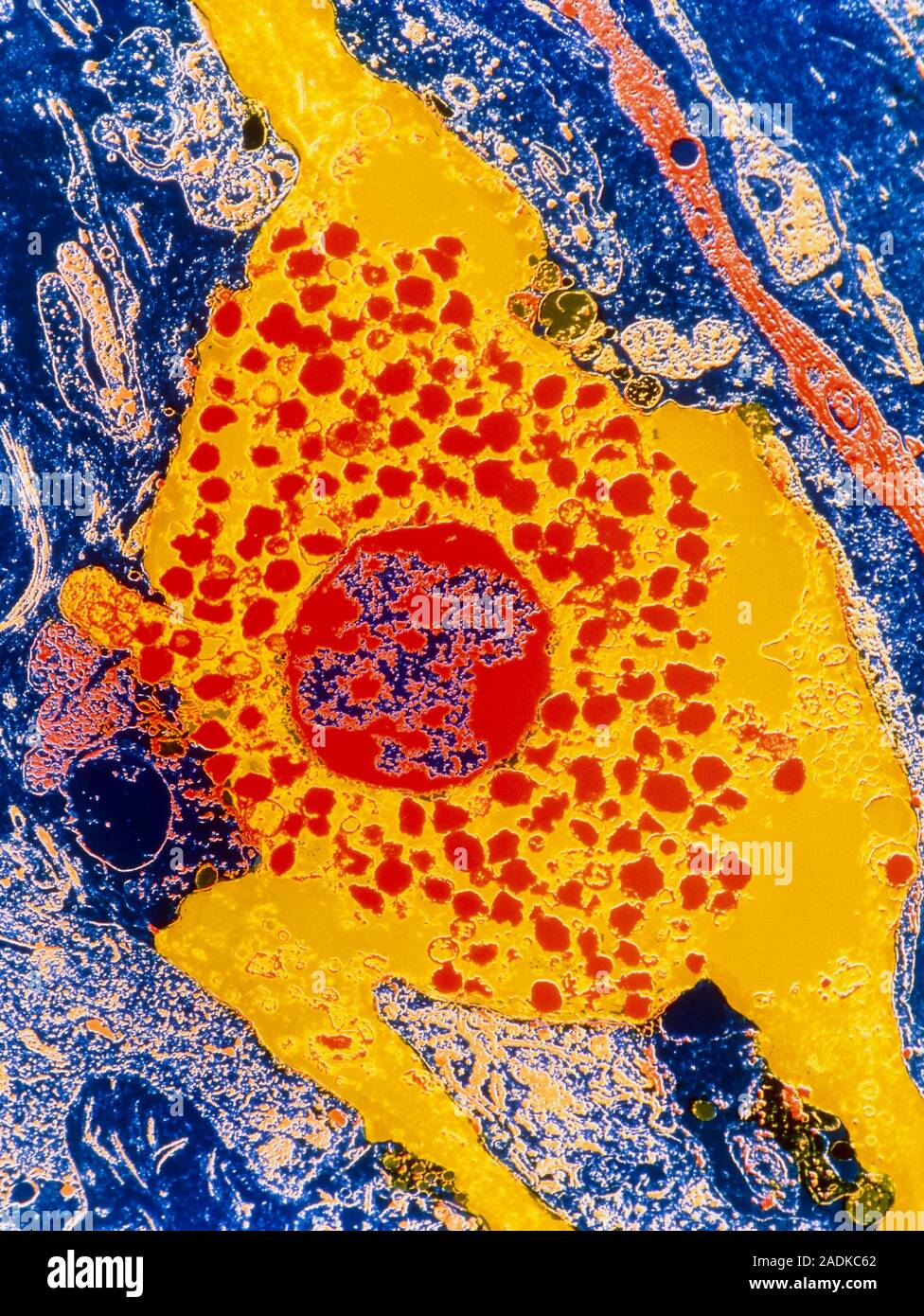 False-colour transmission electron micrograph of a human mast cell in ...