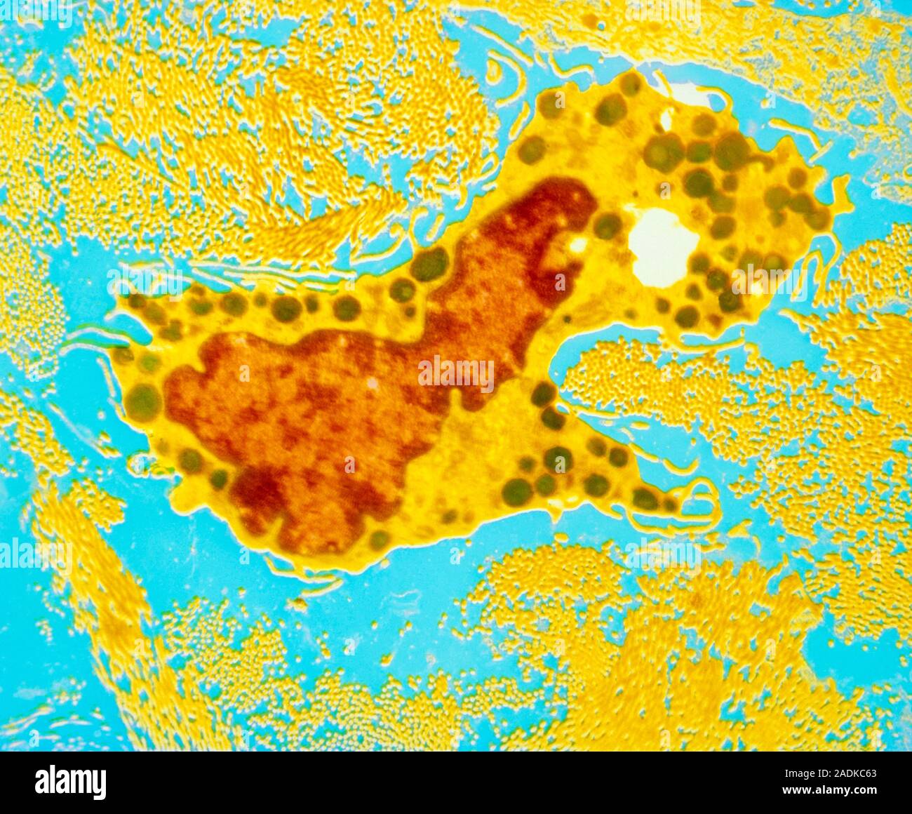 False-colour transmission electron micrograph (TEM) of a human mast ...