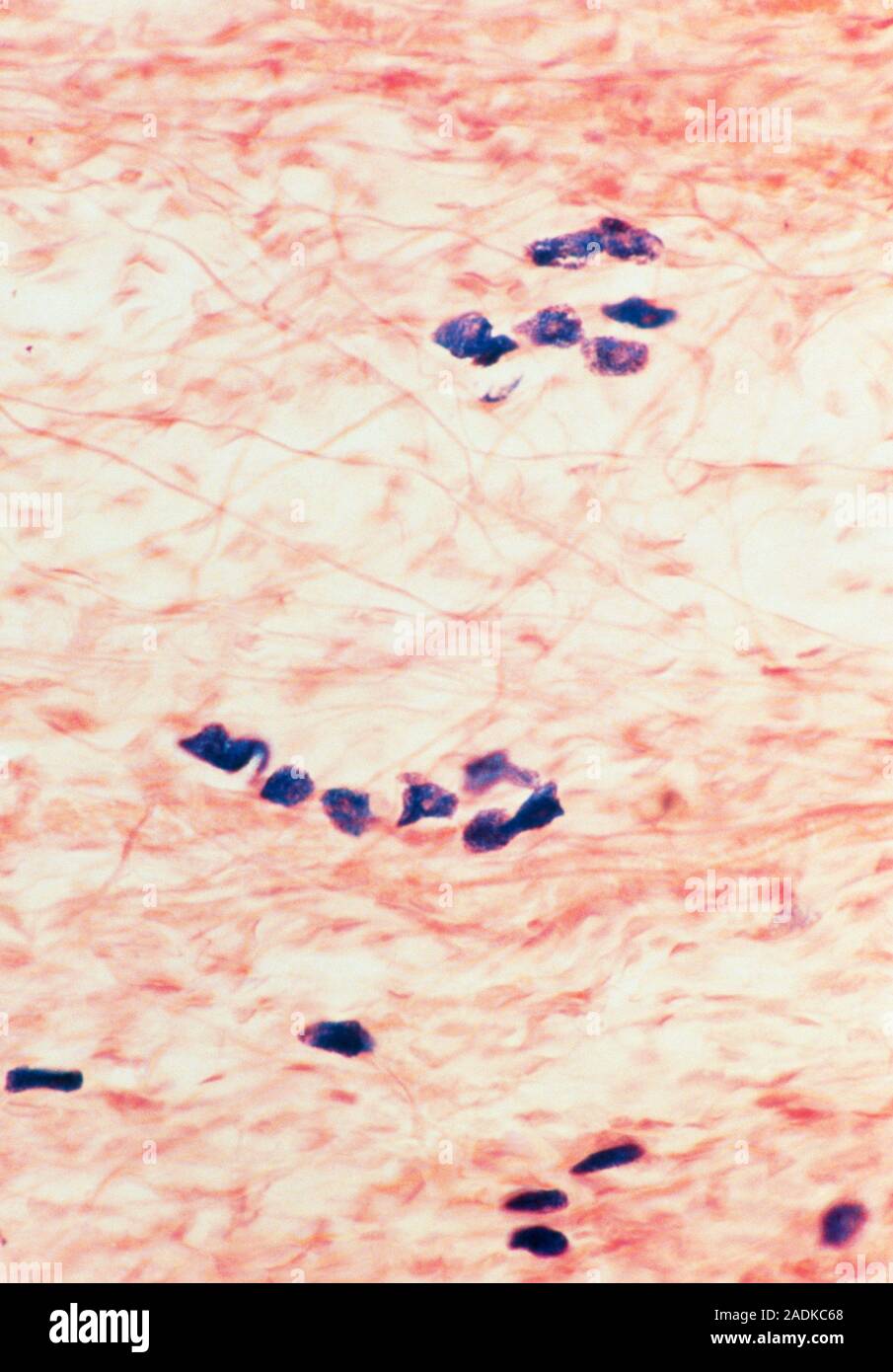 Mast Cells. Light micrograph of a section through human connective ...