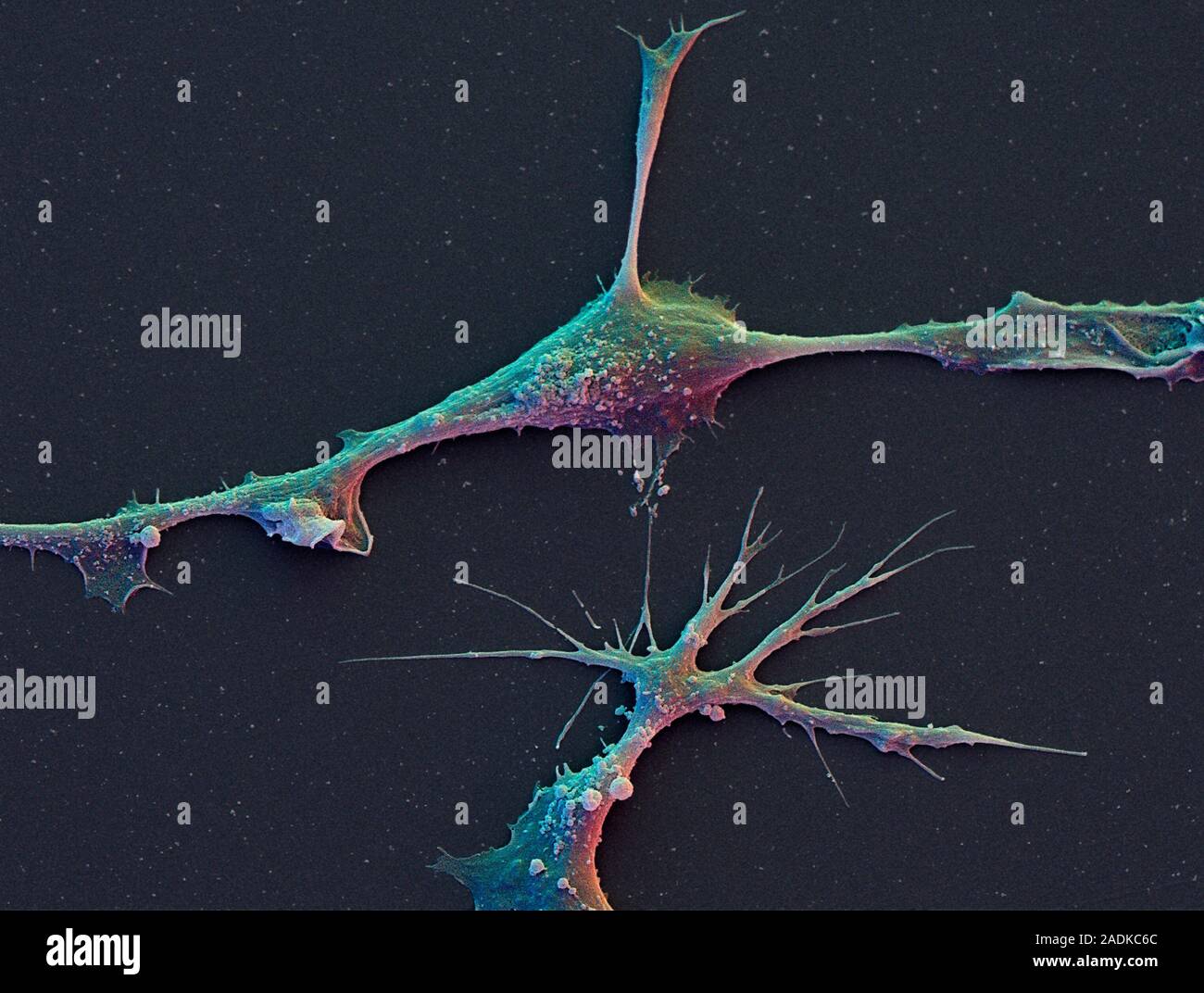 Dendritic cells. Coloured Scanning Electron Micrograph (SEM) of ...