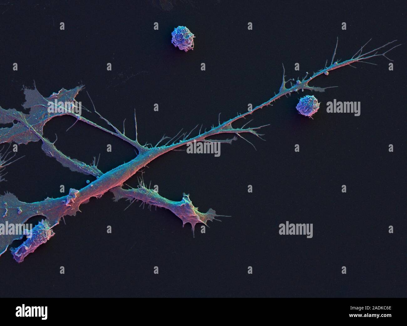 Dendritic and T-cells. Coloured Scanning Electron Micrograph (SEM) of ...