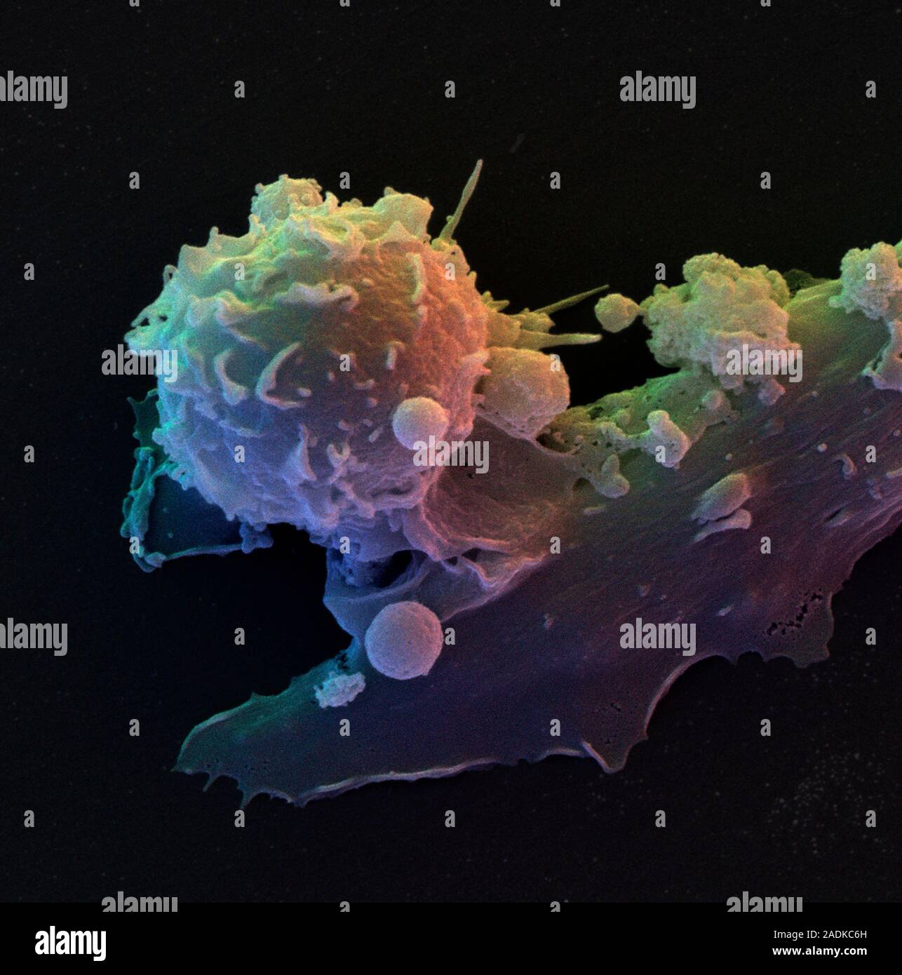 Dendritic and T-cells. Coloured Scanning Electron Micrograph (SEM) of ...