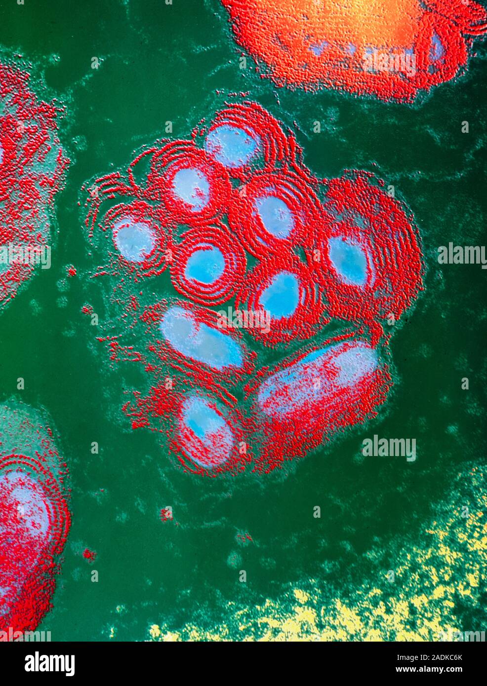 Granules in a mast cell. Coloured transmission electron micrograph (TEM ...