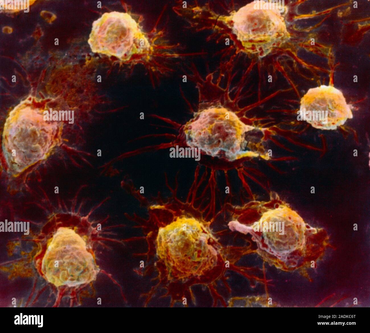 Umbilical cord mast cells. Coloured scanning electron micrograph (SEM ...