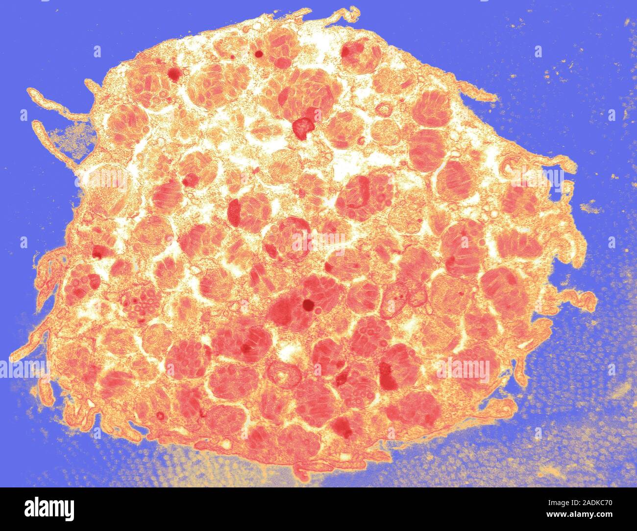 Mast cell. Coloured transmission electron micrograph (TEM) of a section ...