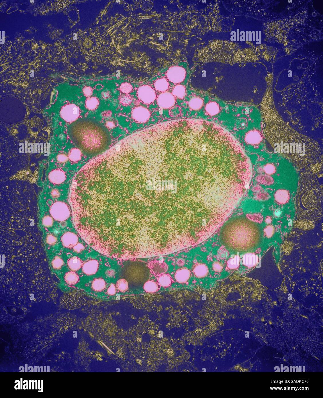 Mast cell. Coloured transmission electron micrograph (TEM) of a section ...