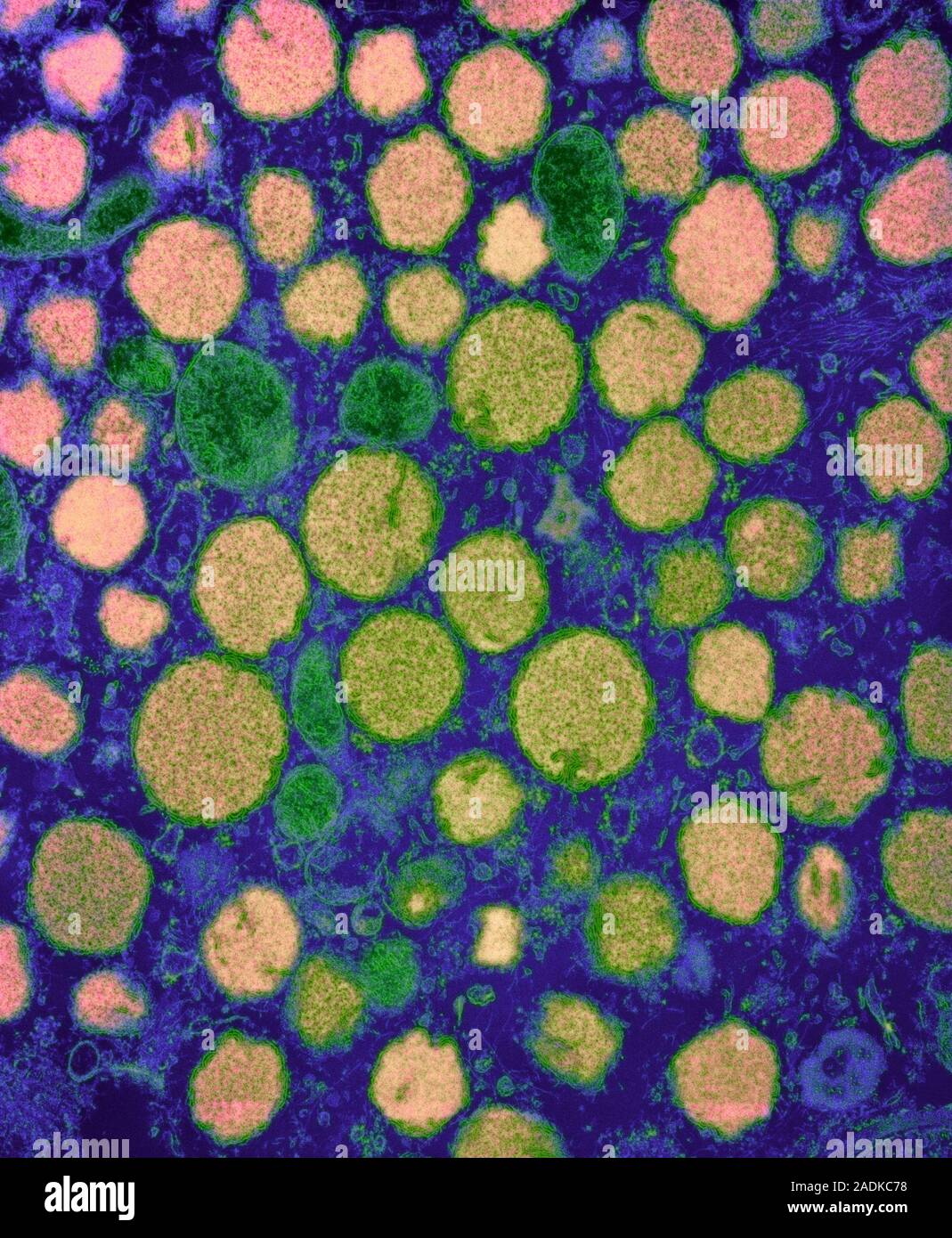 Mast cell granules. Coloured transmission electron micrograph (TEM) of ...