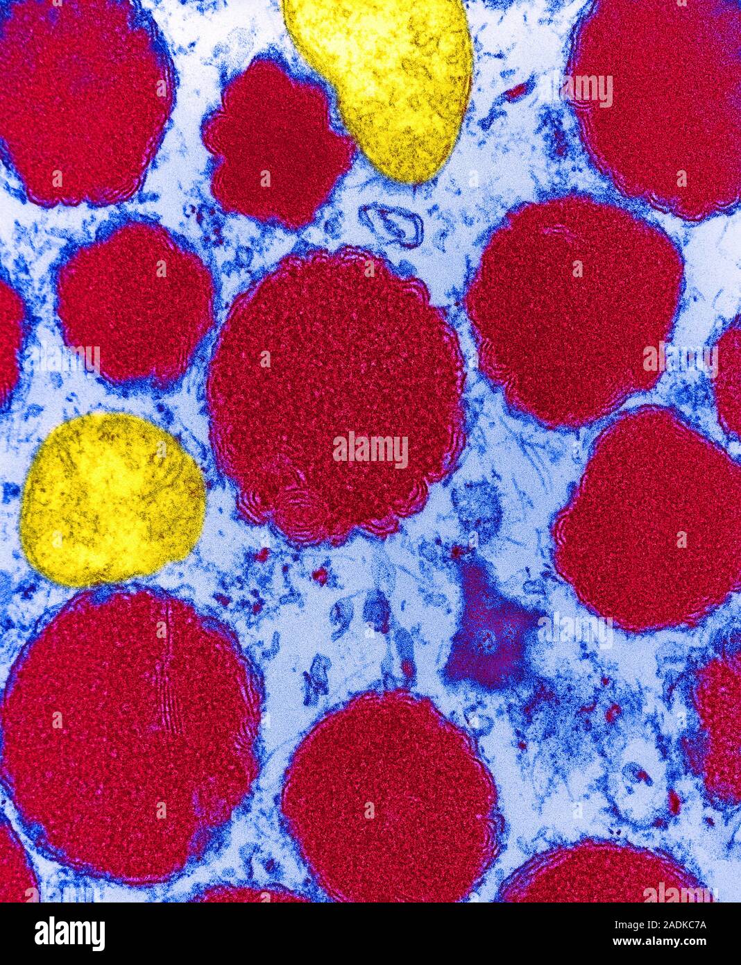 Mast cell granules. Coloured transmission electron micrograph (TEM) of ...