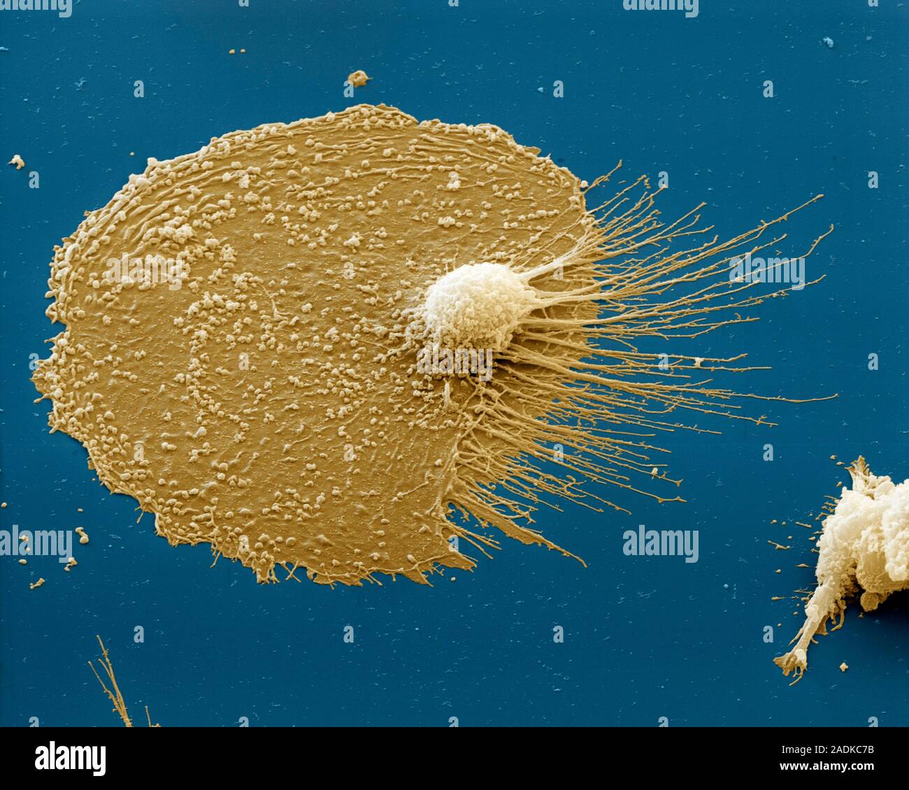 Dendritic cell. Coloured scanning electron micrograph (SEM) of a ...