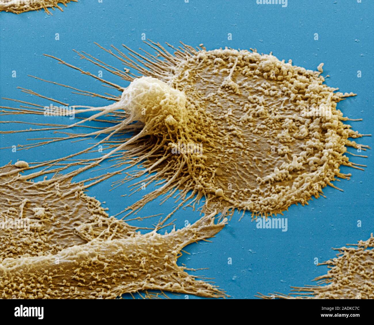 Dendritic cell. Coloured scanning electron micrograph (SEM) of a ...