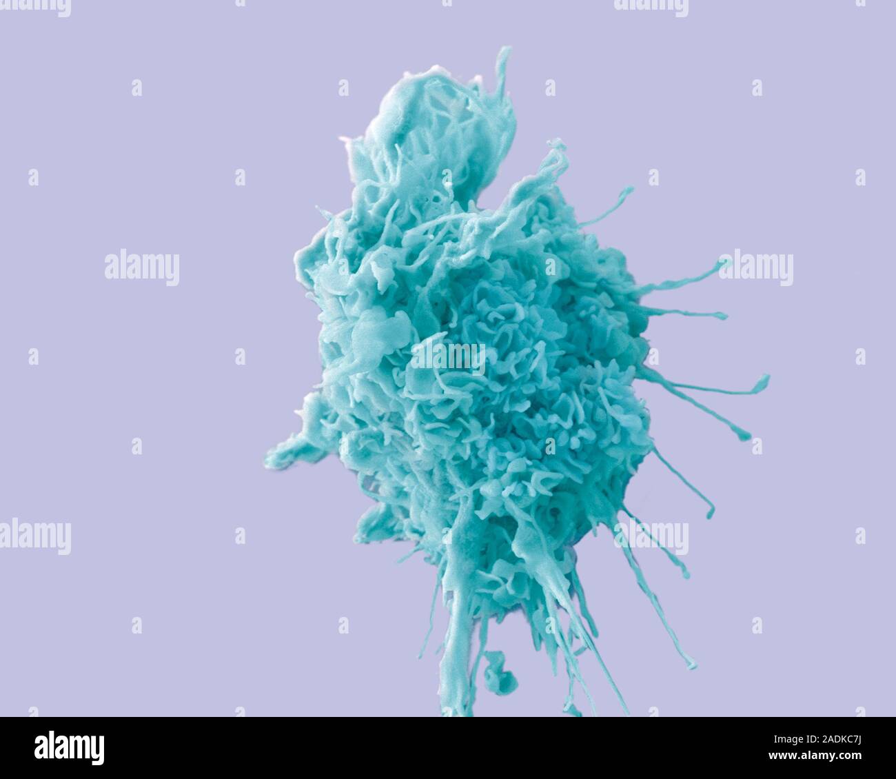 Dendritic cell, coloured scanning electron micrograph (SEM). Dendritic ...
