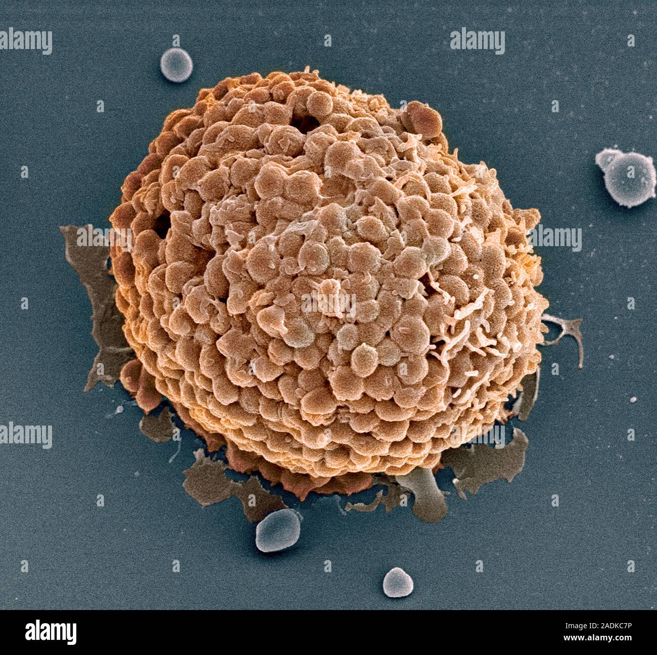 Mast cell, coloured scanning electron micrograph (SEM). Mast cells are ...