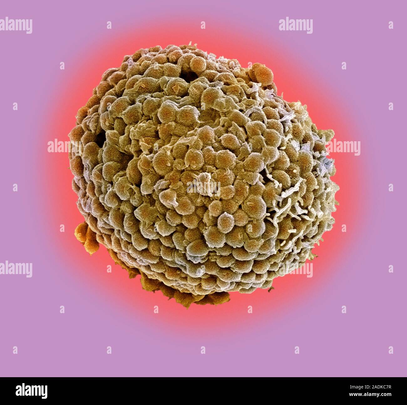 Mast cell, coloured scanning electron micrograph (SEM). Mast cells are ...