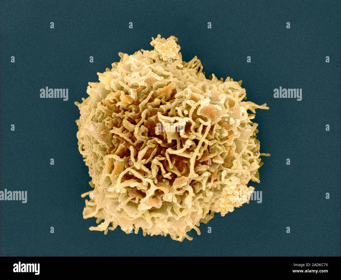 White blood cell. Coloured scanning electron micrograph (SEM) of a ...