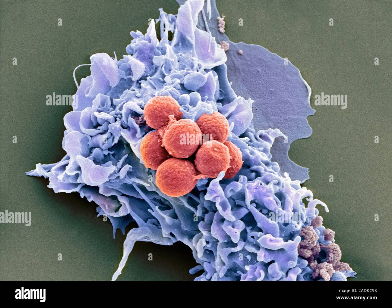Phagocytosis of fungus spores. Coloured scanning electron micrograph ...