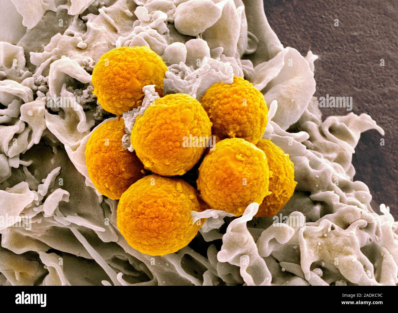 Phagocytosis of fungus spores. Coloured scanning electron micrograph ...