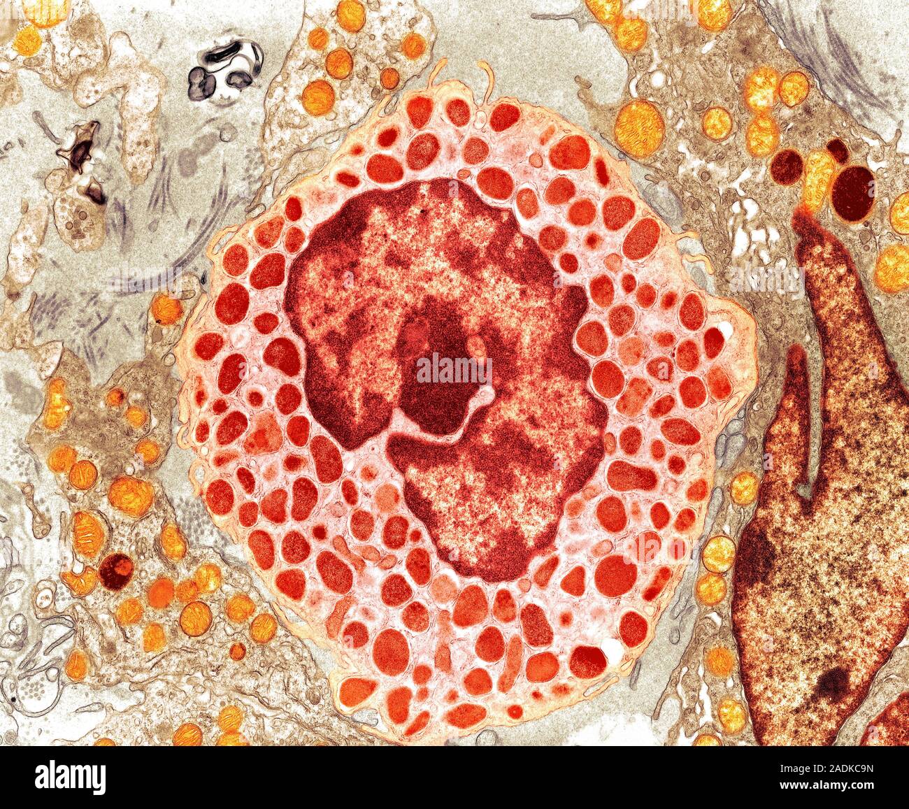 Mast cell, coloured transmission electron micrograph (TEM). Mast cells ...