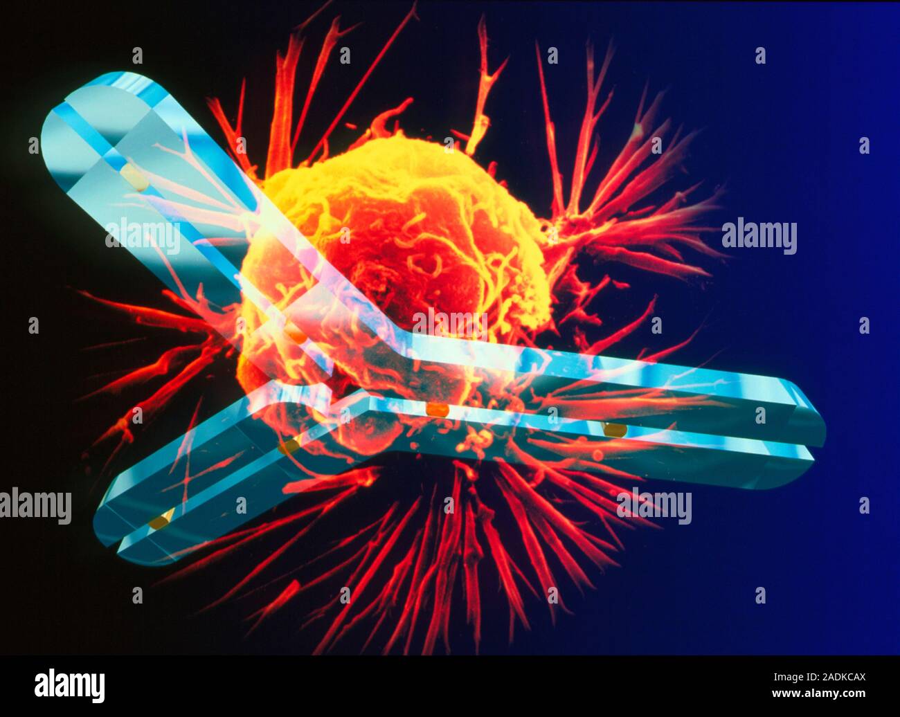 Antibody and cancer. Computer illustration of an antibody seen with a ...