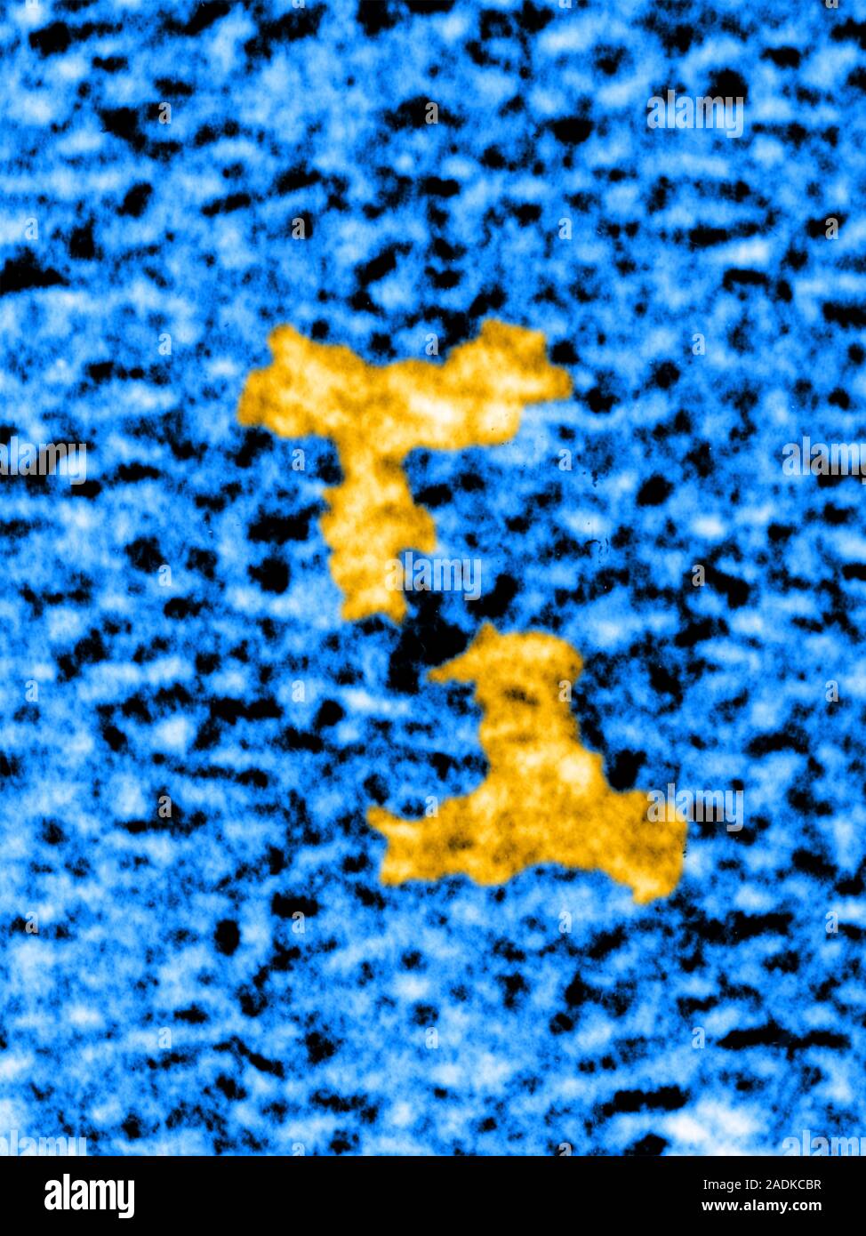 Immunoglobulin G antibody molecules, coloured transmission electron ...