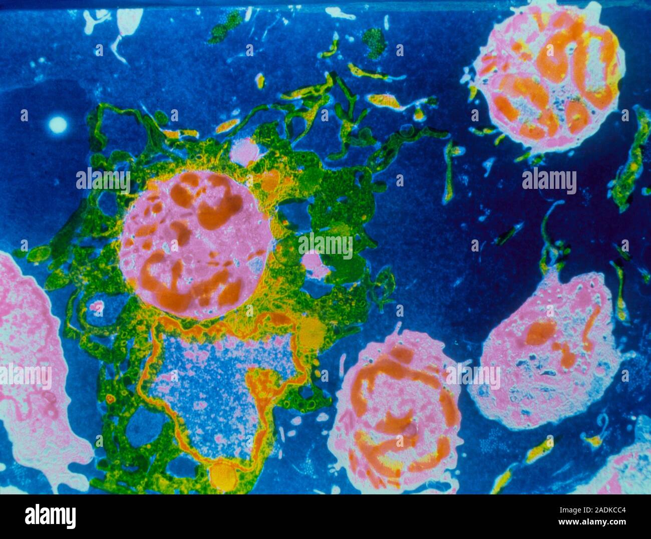 False-colour transmission electron micrograph (TEM) of a human ...