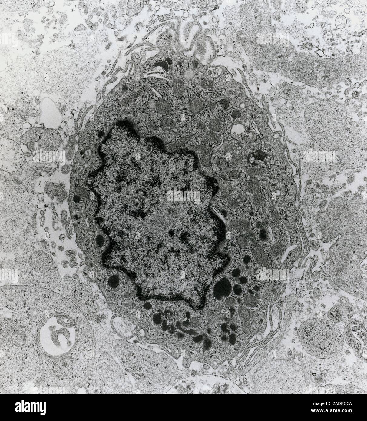 Transmission electron micrograph of a macrophage from a human tumour ...