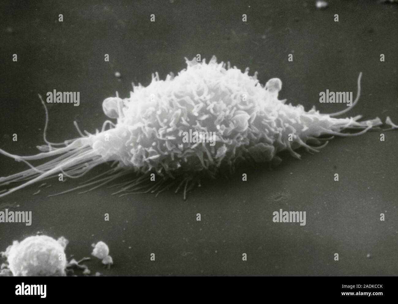 Scanning electron micrograph (SEM) of a macrophage cell moving over a surface. Wandering ...