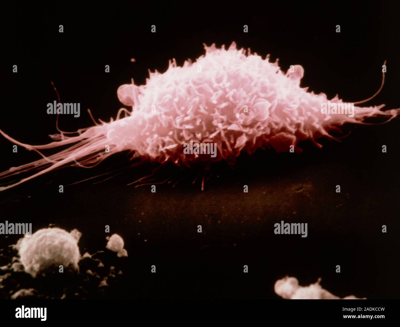 False-colour scanning electron micrograph (SEM) of a macrophage cell moving over a surface ...