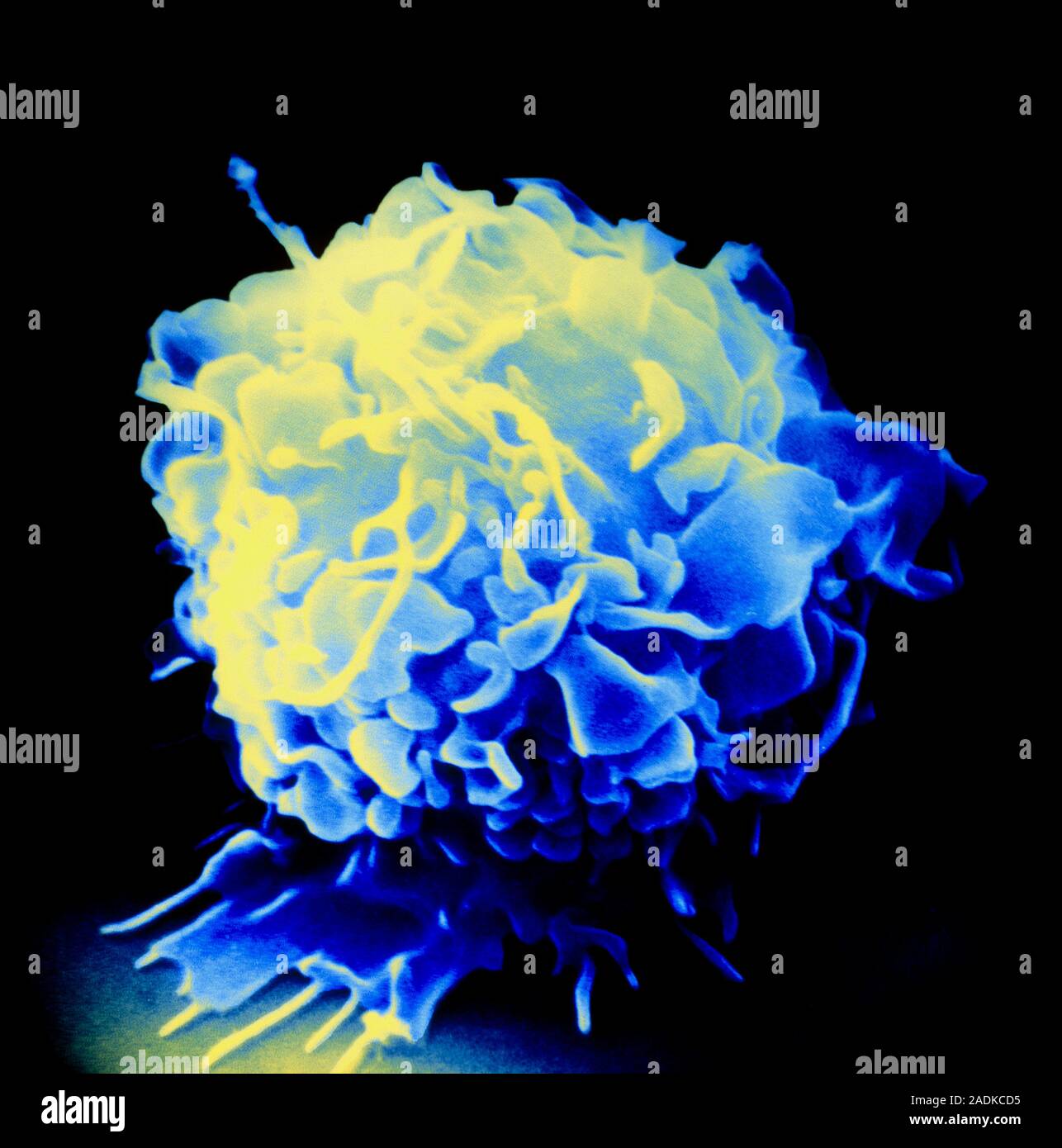 Coloured scanning electron micrograph (SEM) of a macrophage cell moving over a surface ...