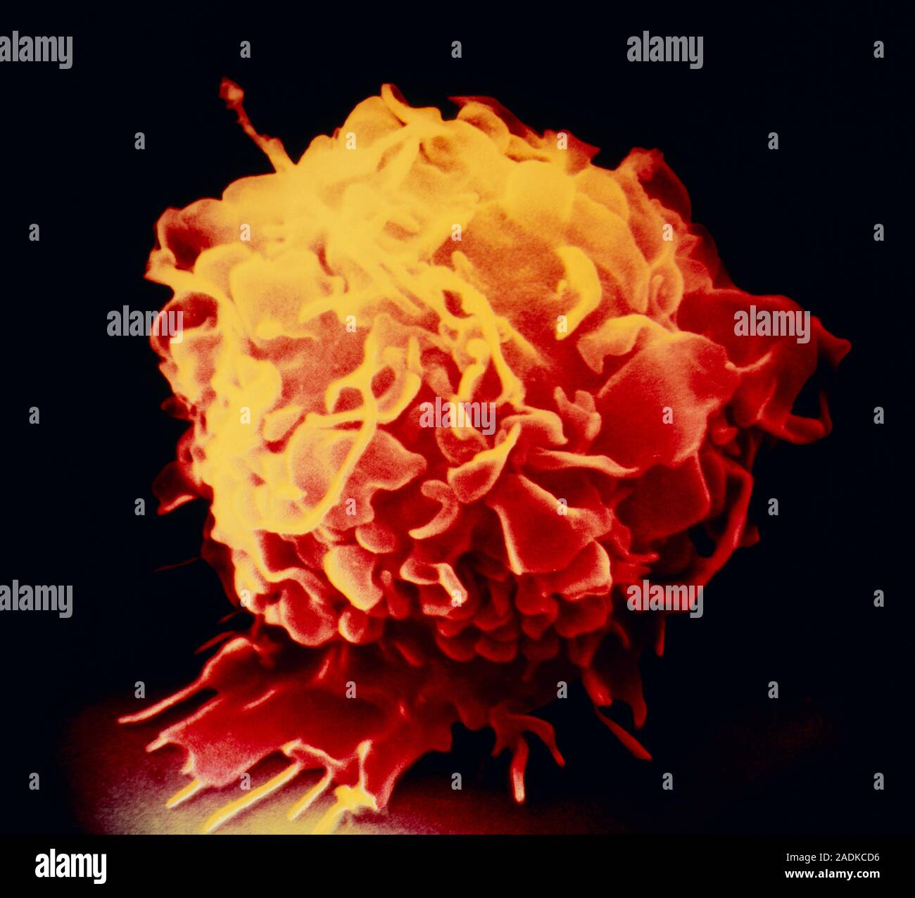 Coloured scanning electron micrograph (SEM) of a macrophage cell moving over a surface ...