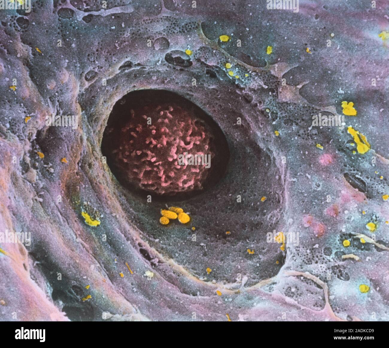 Monocyte. Coloured Scanning Electron Micrograph (SEM) of a monocyte ...