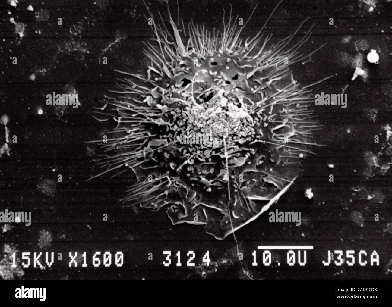 Microglial cell. Scanning electron micrograph of a human microglial ...
