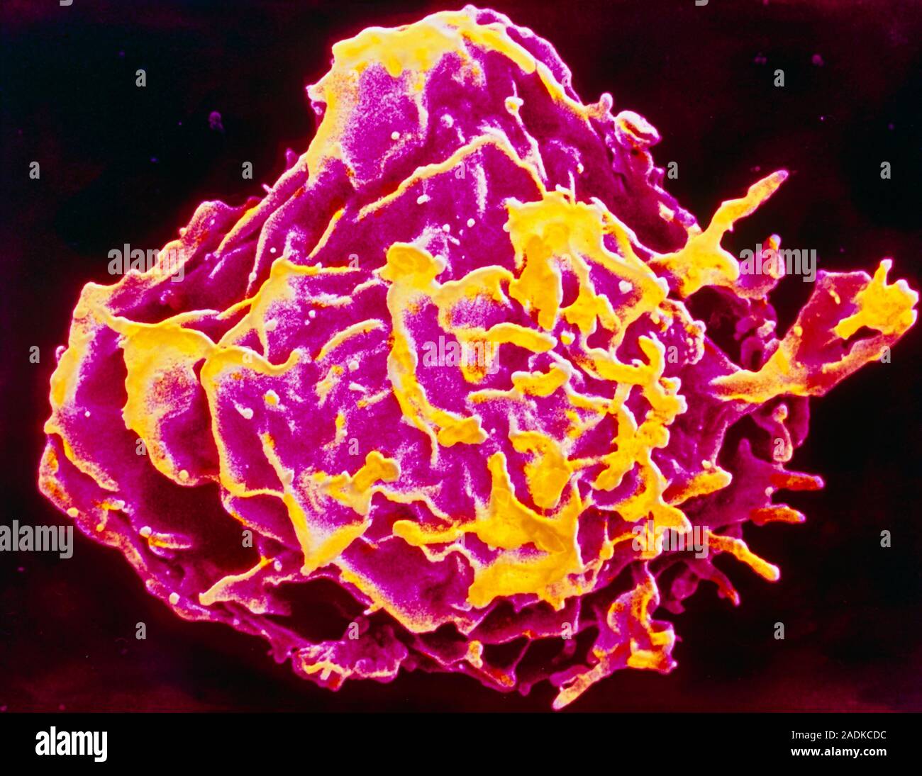 Macrophage. Coloured scanning electron micrograph of a macrophage ...