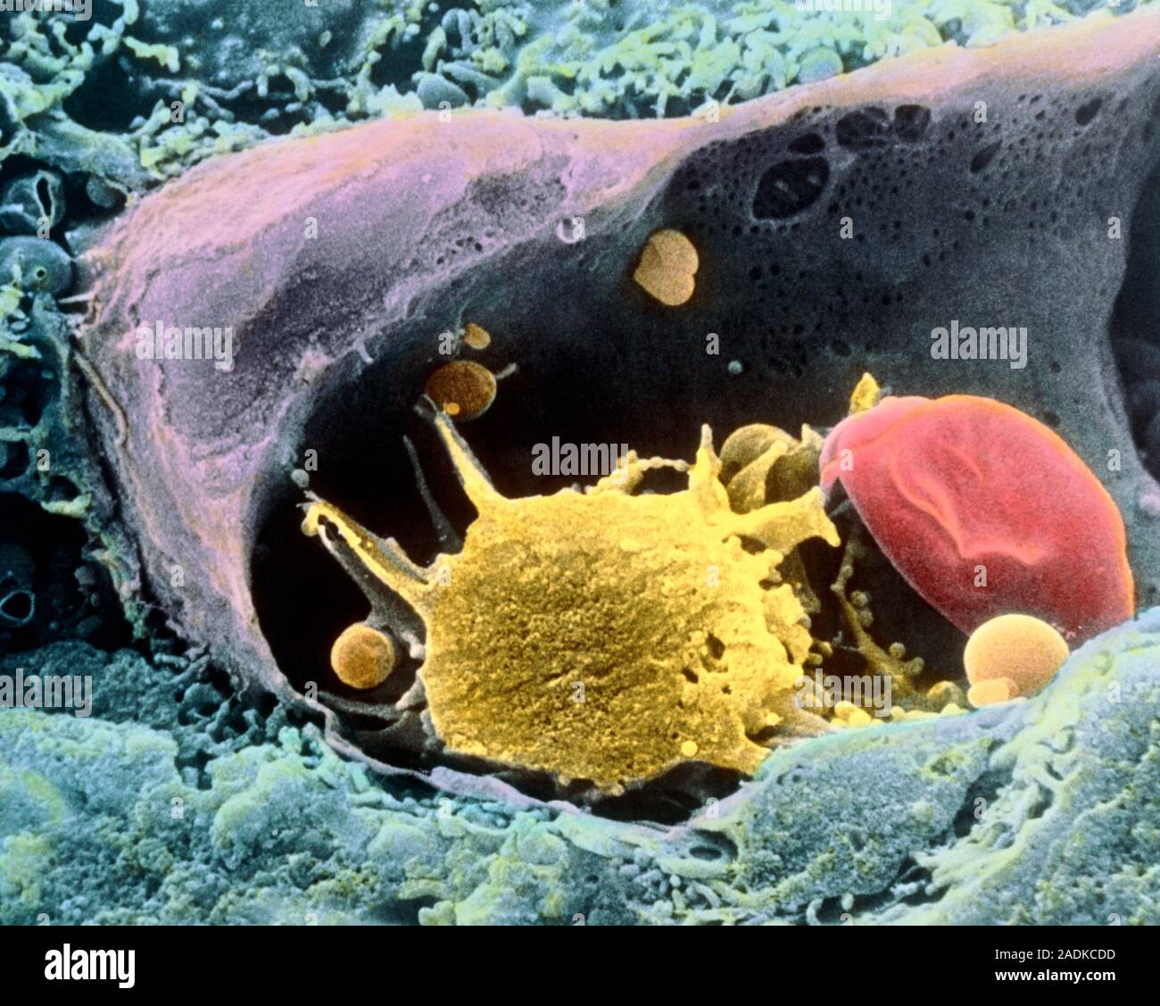 Monocyte. Coloured Scanning Electron Micrograph (SEM) of a monocyte ...