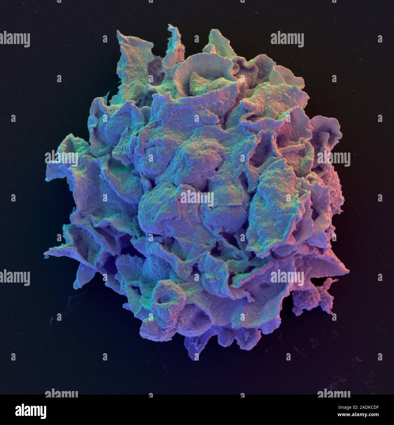 Macrophage. Coloured Scanning Electron Micrograph (SEM) of a macrophage, part of the body's ...