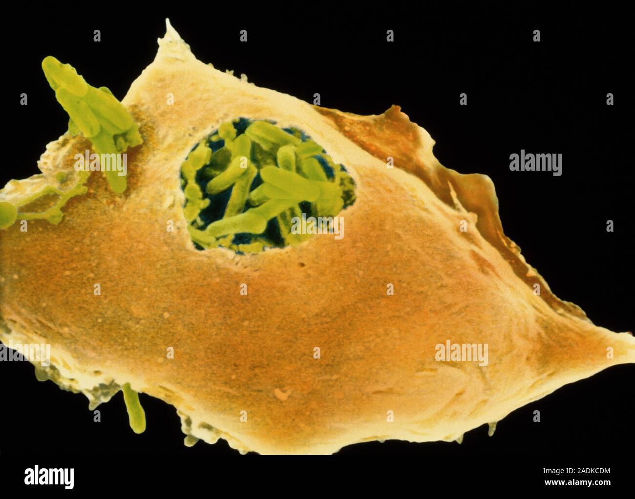 Phagocytosis. Coloured scanning electron micrograph of a macrophage ...