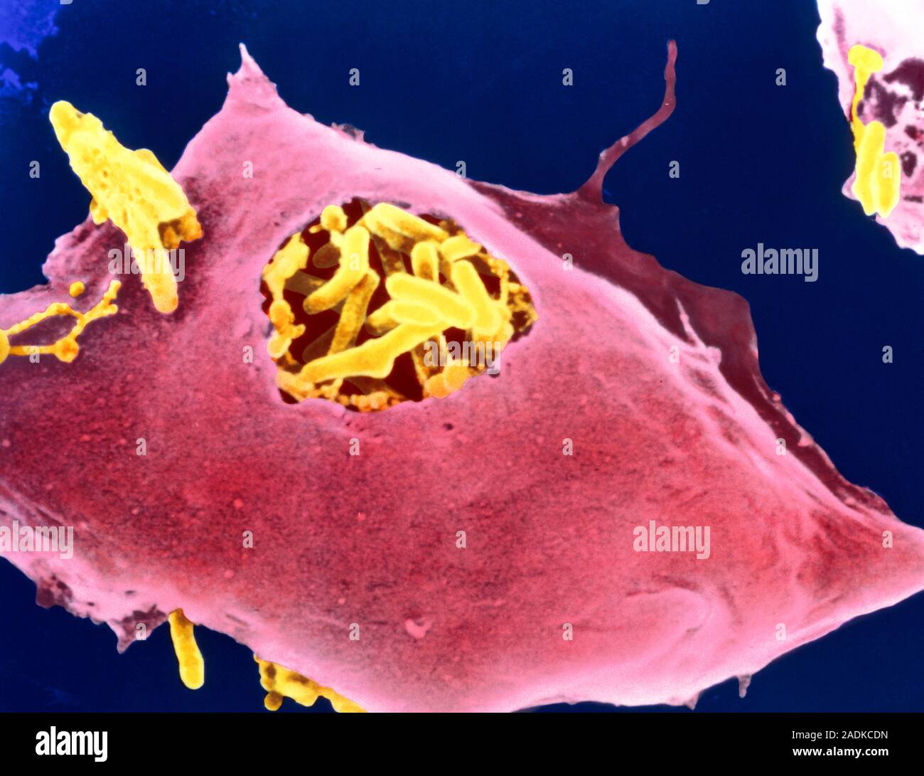 Phagocytosis. Scanning electron micrograph (SEM) of a macrophage cell ...