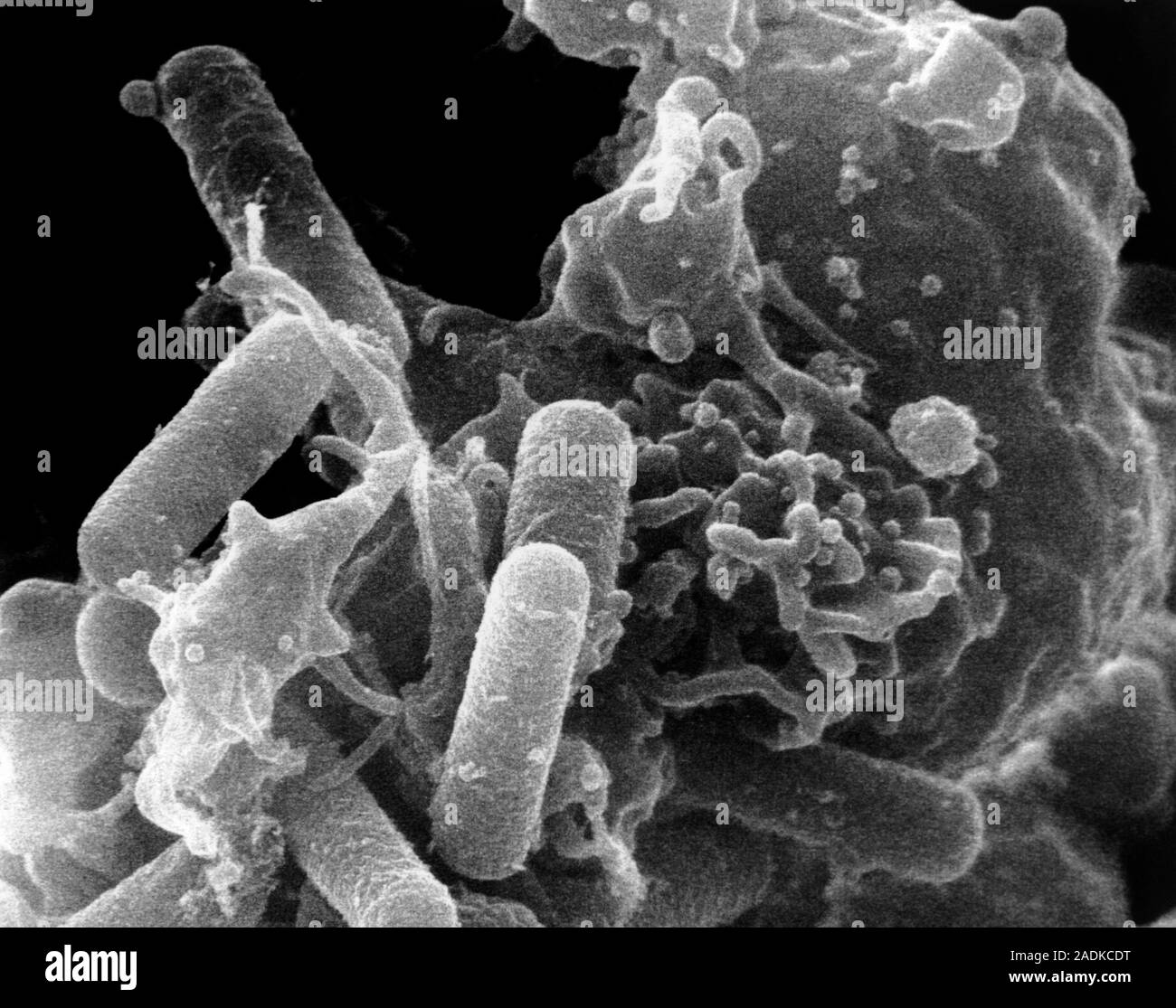 Phagocytic immune response. Scanning electron micrograph of a ...