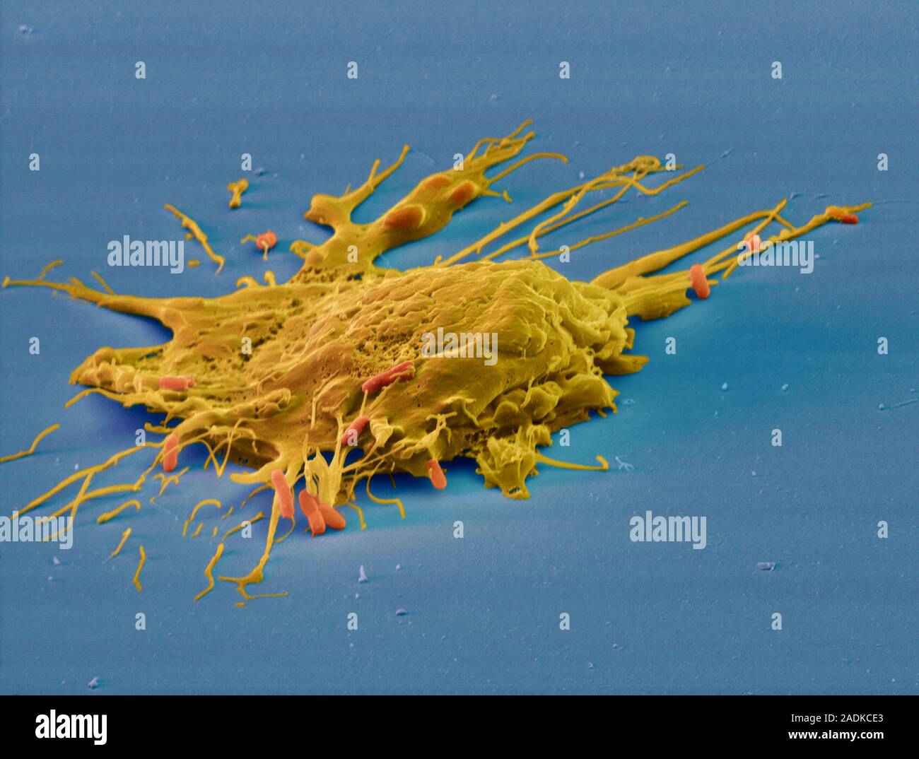 Phagocytosis. Coloured scanning electron microg- raph (SEM) of a ...