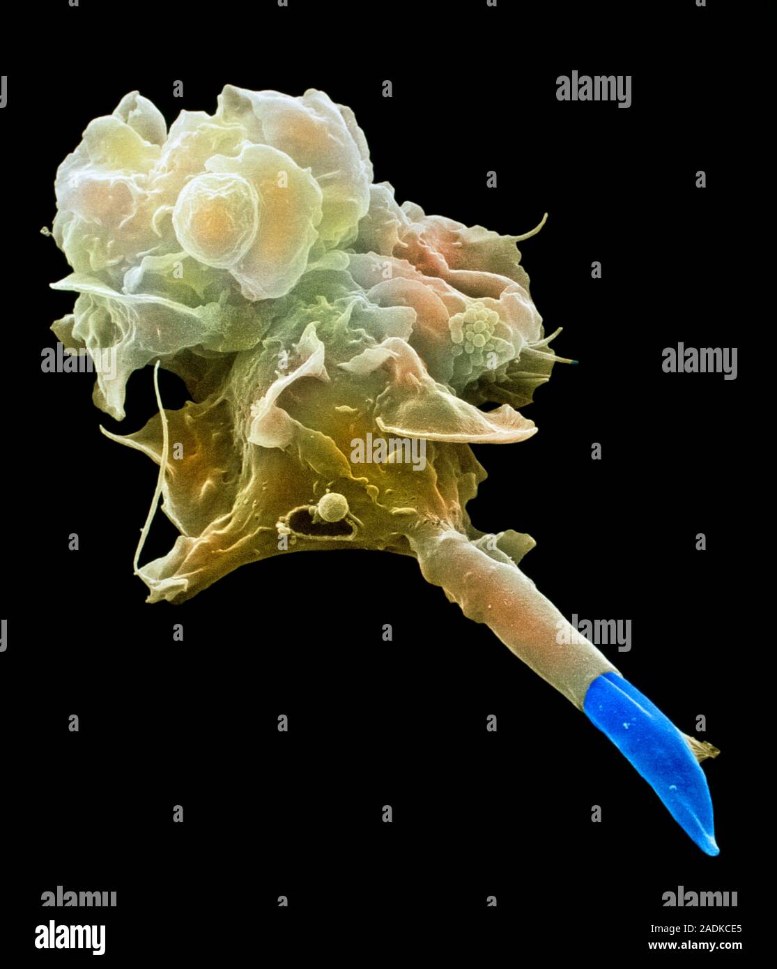Macrophage engulfing Leishmania. Coloured scanning electron micrograph ...