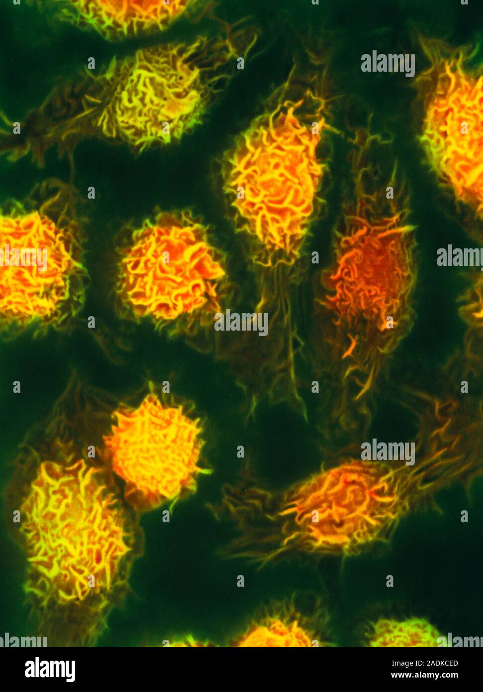 Macrophages. Coloured scanning electron micrograph (SEM) of active macrophage cells. In the ...